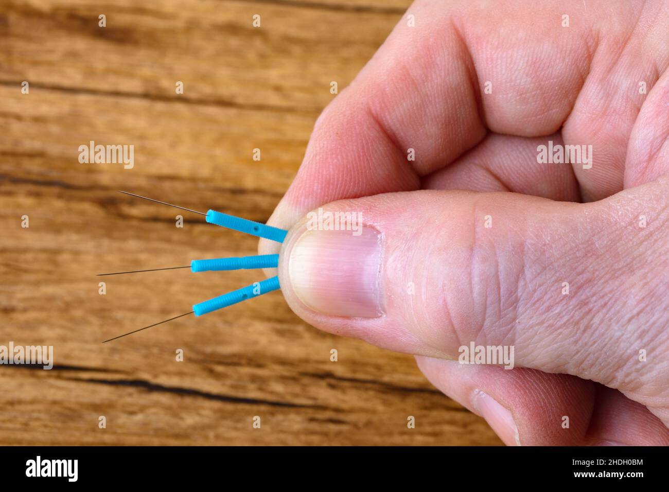 acupuncture, acupuncture needle, chinese medicine, acupunctures ...