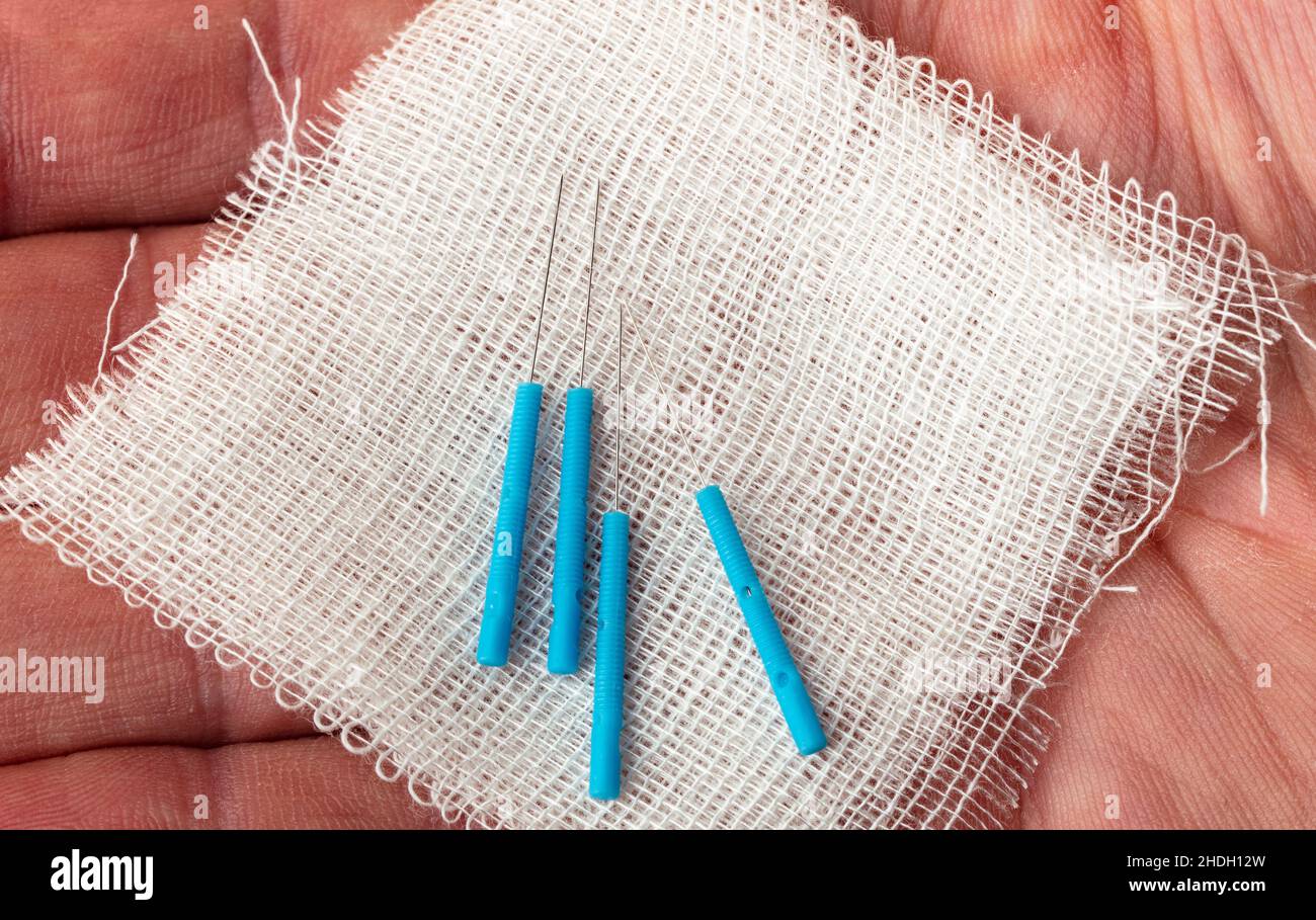 Chinese Acupuncture Needles