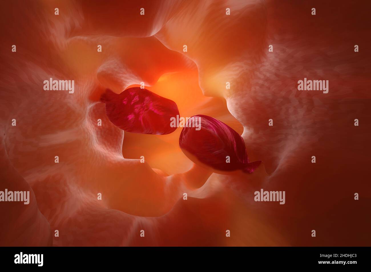 Colon polyp endoscopy hi-res stock photography and images - Alamy