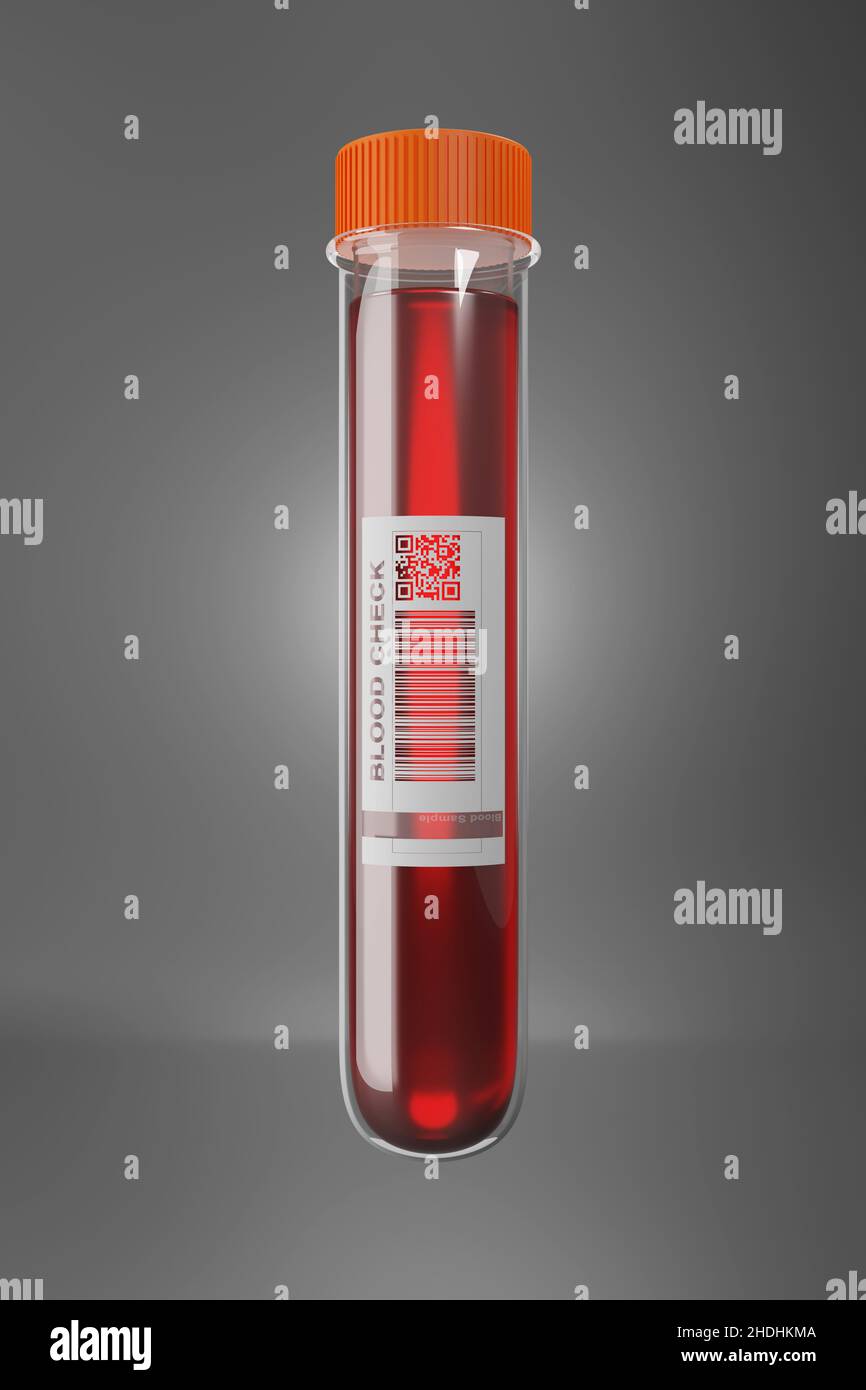 blood sample, blood examination, blood test, blood samples, blood exam ...