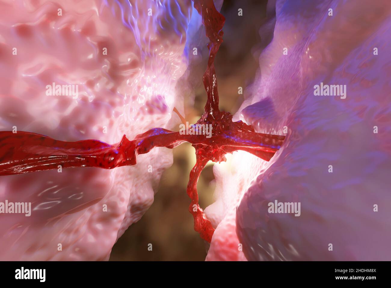 cancer, tissue, microscopic, cancers, tissues Stock Photo - Alamy