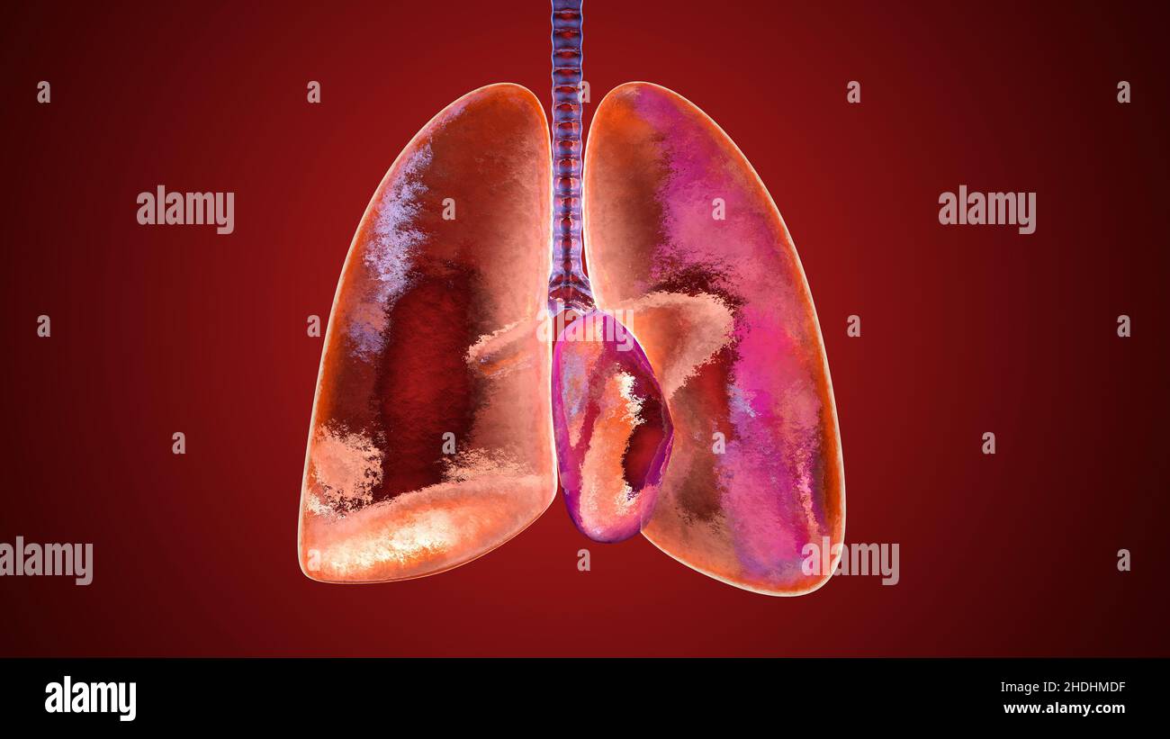 lung, diagnostic, lungs, diagnostics Stock Photo - Alamy