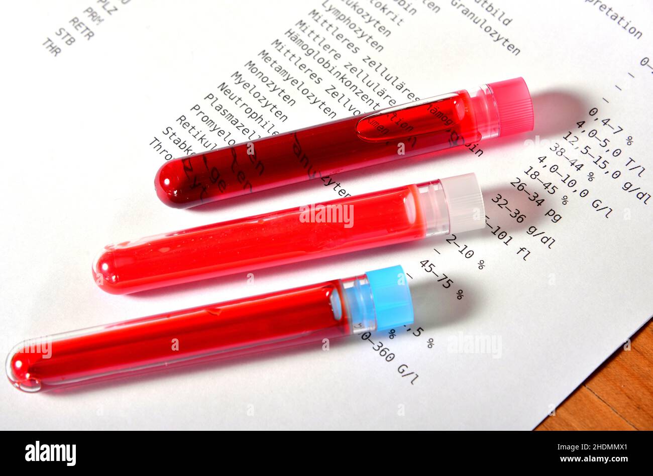 healthcare & medicine, blood test, healthcare & medicines, healthcare ...