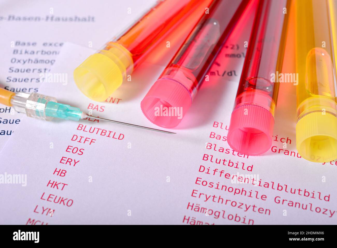 laboratory examination, blood examination, blood test, laboratory ...