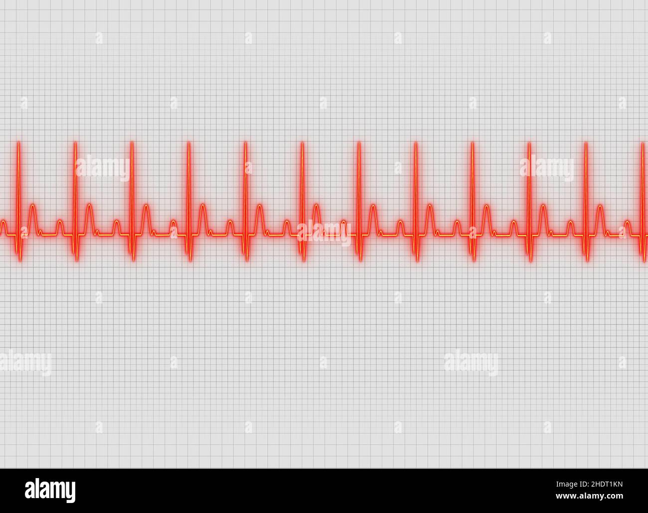 pulsating, heartbeat, ecg, heart rate, heartbeats, ekg Stock Photo - Alamy