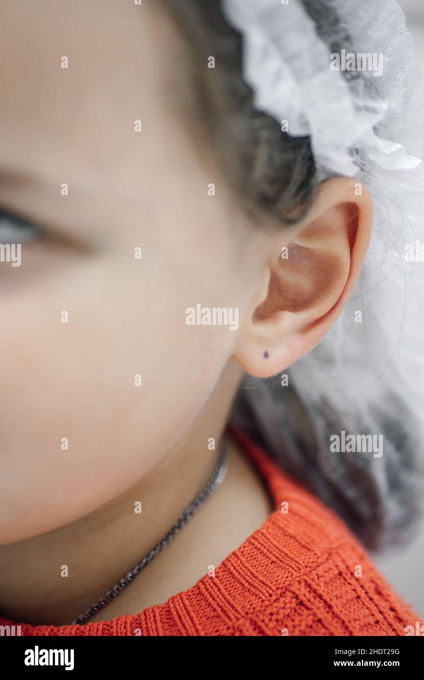 Close-up of little girl ear with black dot from marker. Preparation for ...