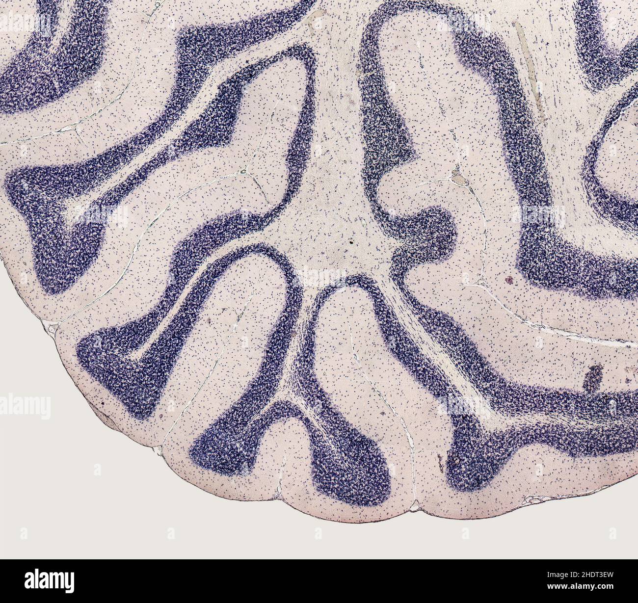 brain, microscopy, brains, microscopies Stock Photo - Alamy