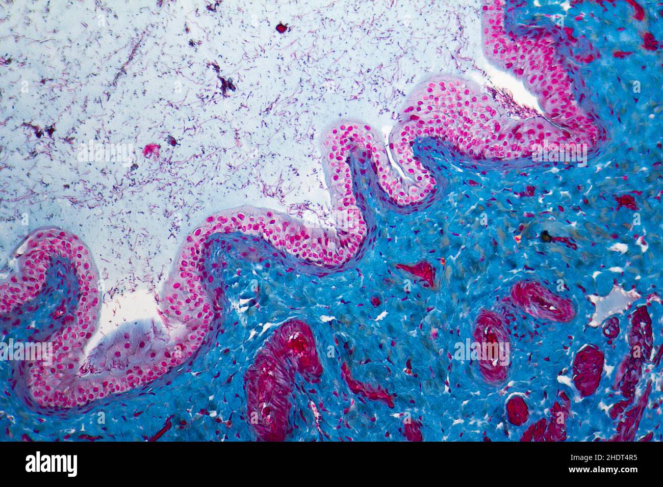 microscopy, bladder, microscopies, bladders Stock Photo - Alamy