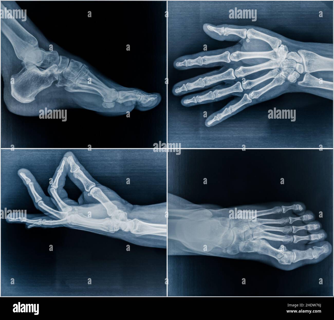 hand, foot, hands, feet, foots Stock Photo - Alamy