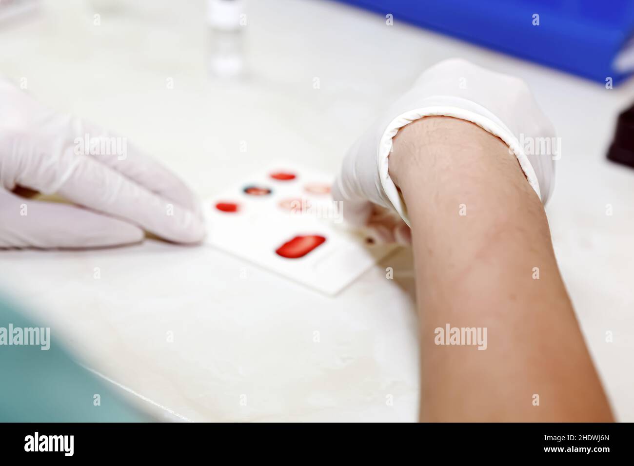 research, diagnostic, blood sample, researchs, diagnostics, blood ...