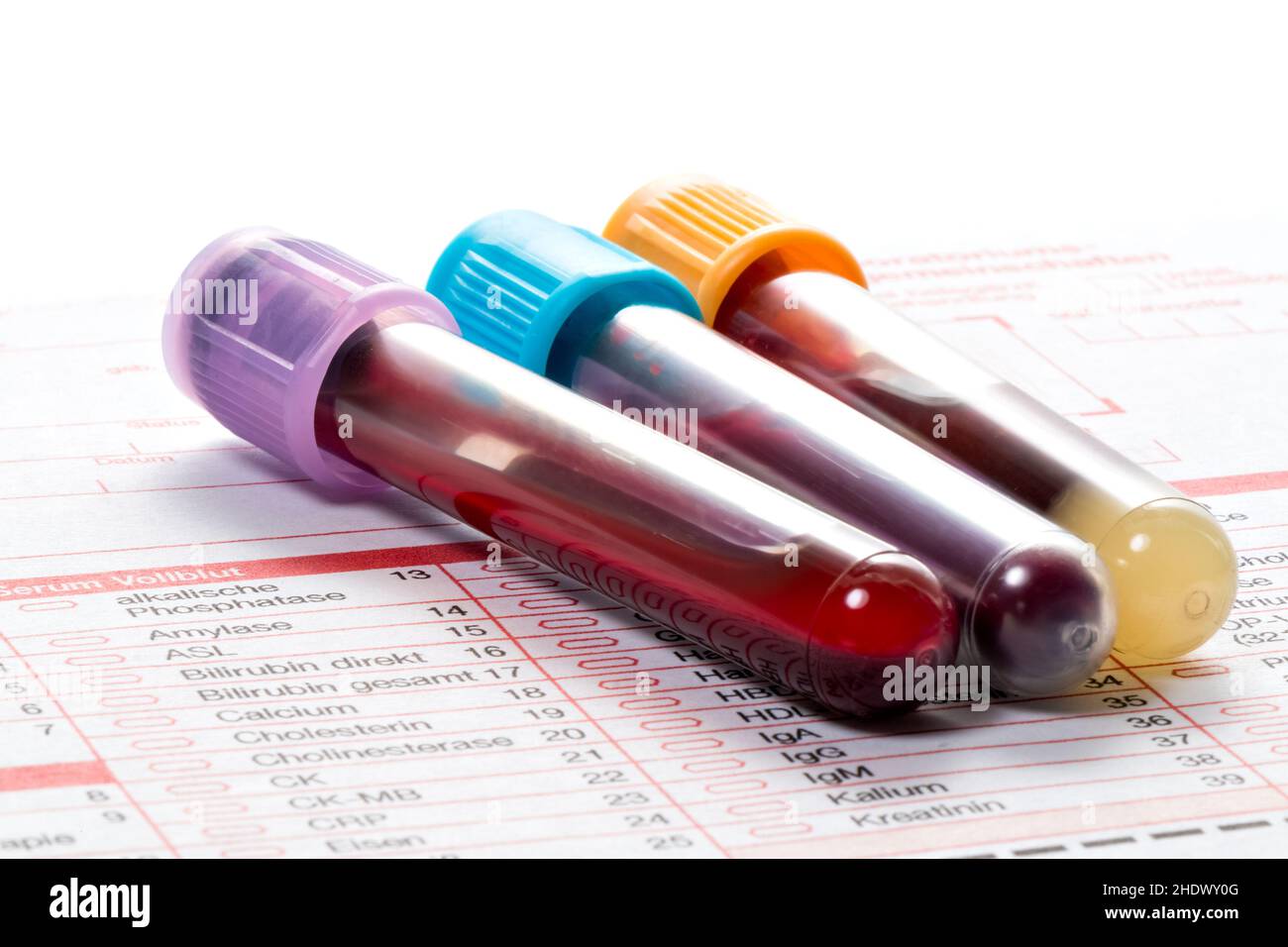 blood, blood examination, blood test, bloods, blood exam, blood ...