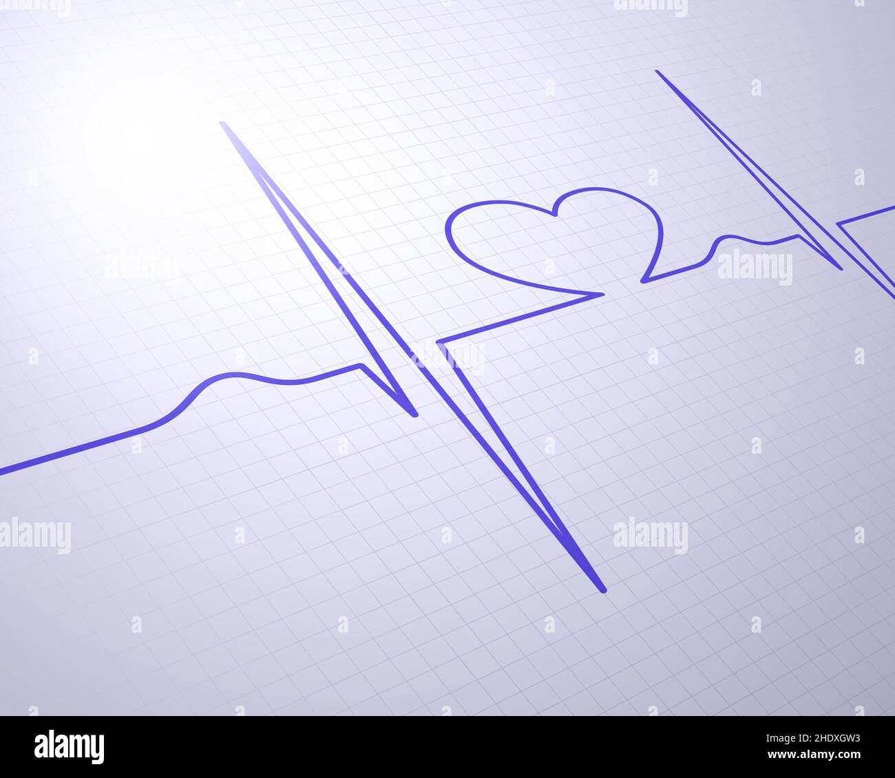 ecg, pulse trace, ekg, heart rate, pulse traces Stock Photo - Alamy