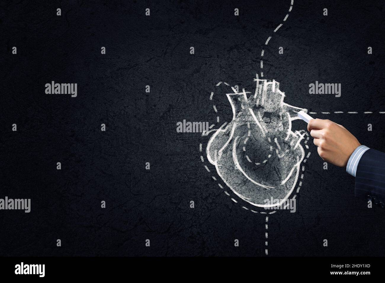 heart, engine, anatomy, hearts, engines, motor, anatomies Stock Photo ...