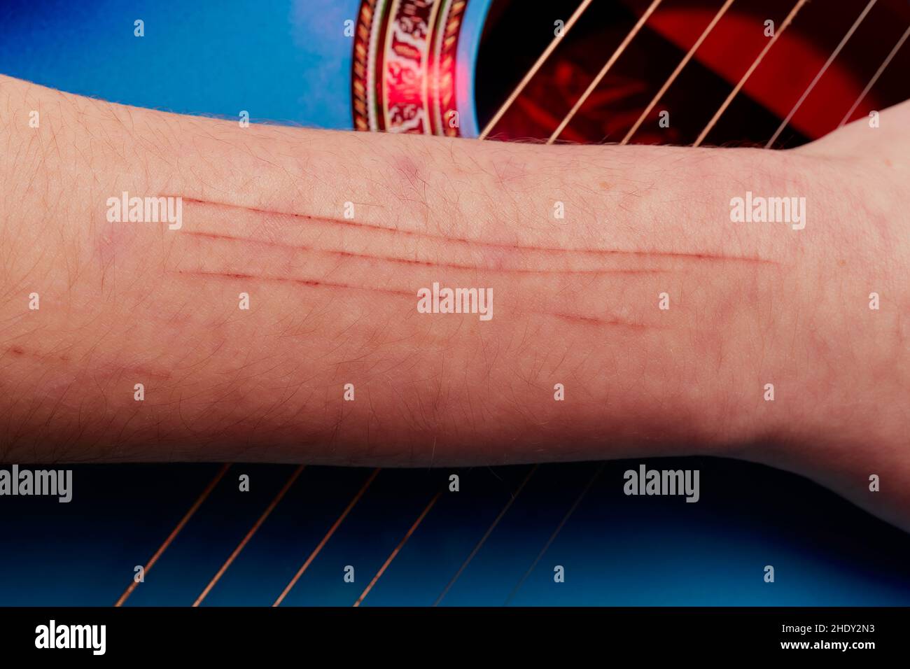 The skin condition after cat scratch and bite of veterinary surgeon ...