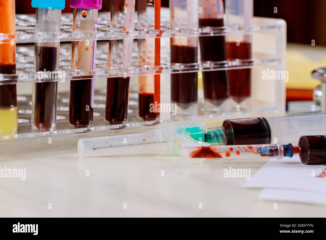 examination, laboratory, blood sample, procedure, laboratories, blood ...