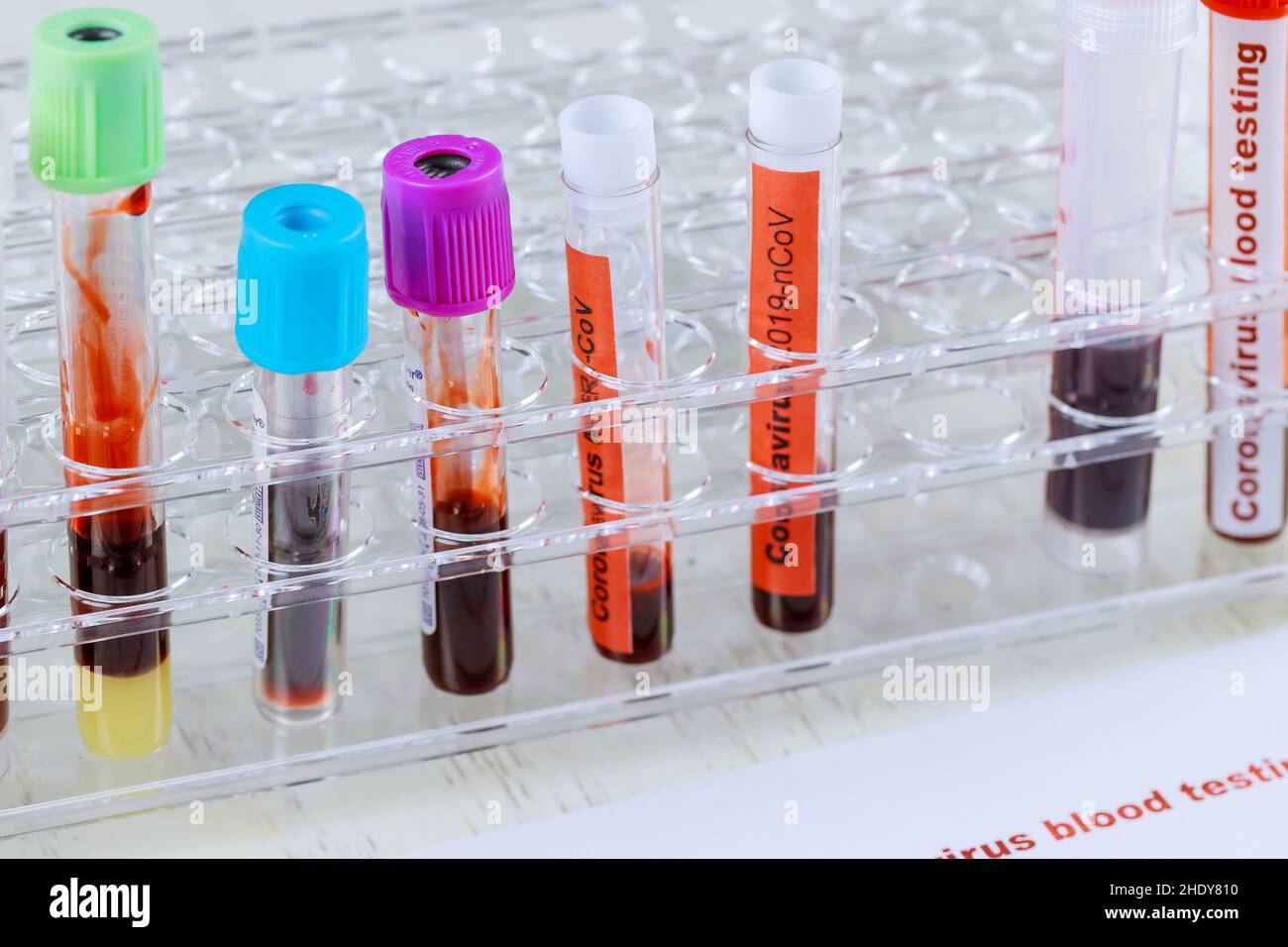laboratory, blood sample, corona virus, laboratories, blood samples ...