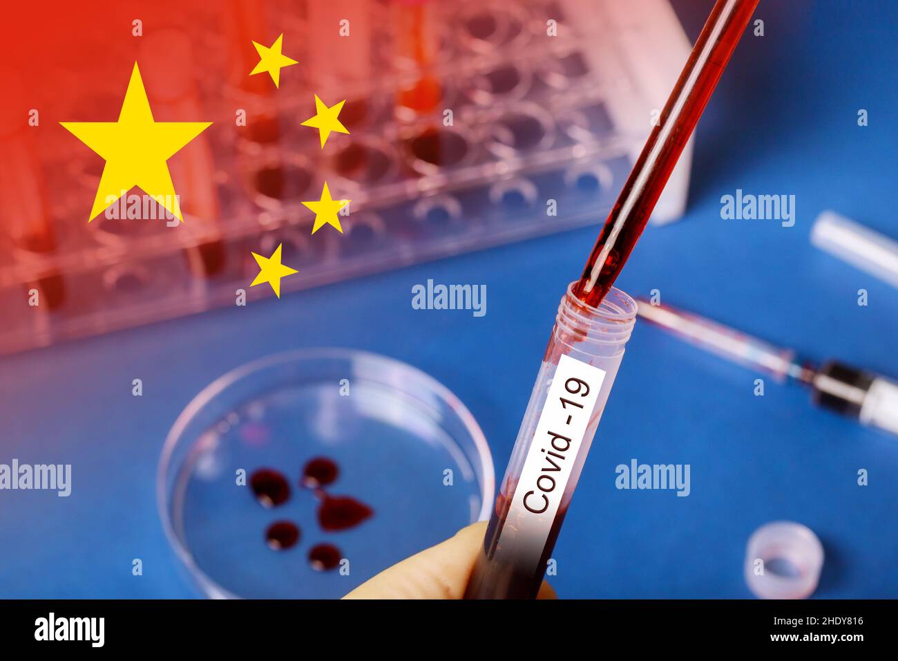 laboratory examination, infection, covid-19, laboratory examinations ...