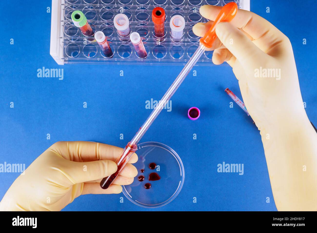 laboratory examination, diagnostic, blood sample, laboratory ...