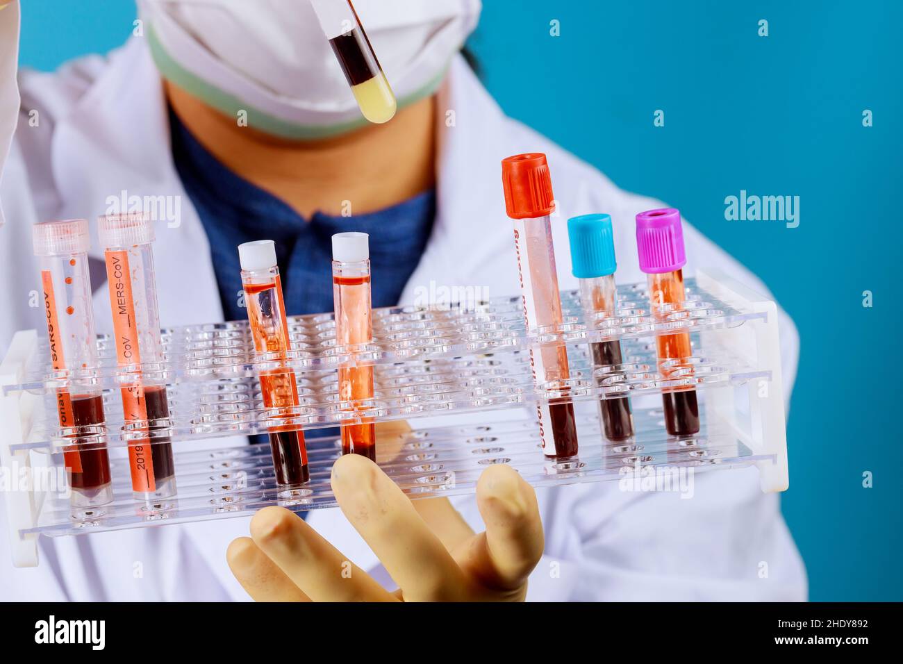 laboratory examination, blood sample, blood test, infection, laboratory ...