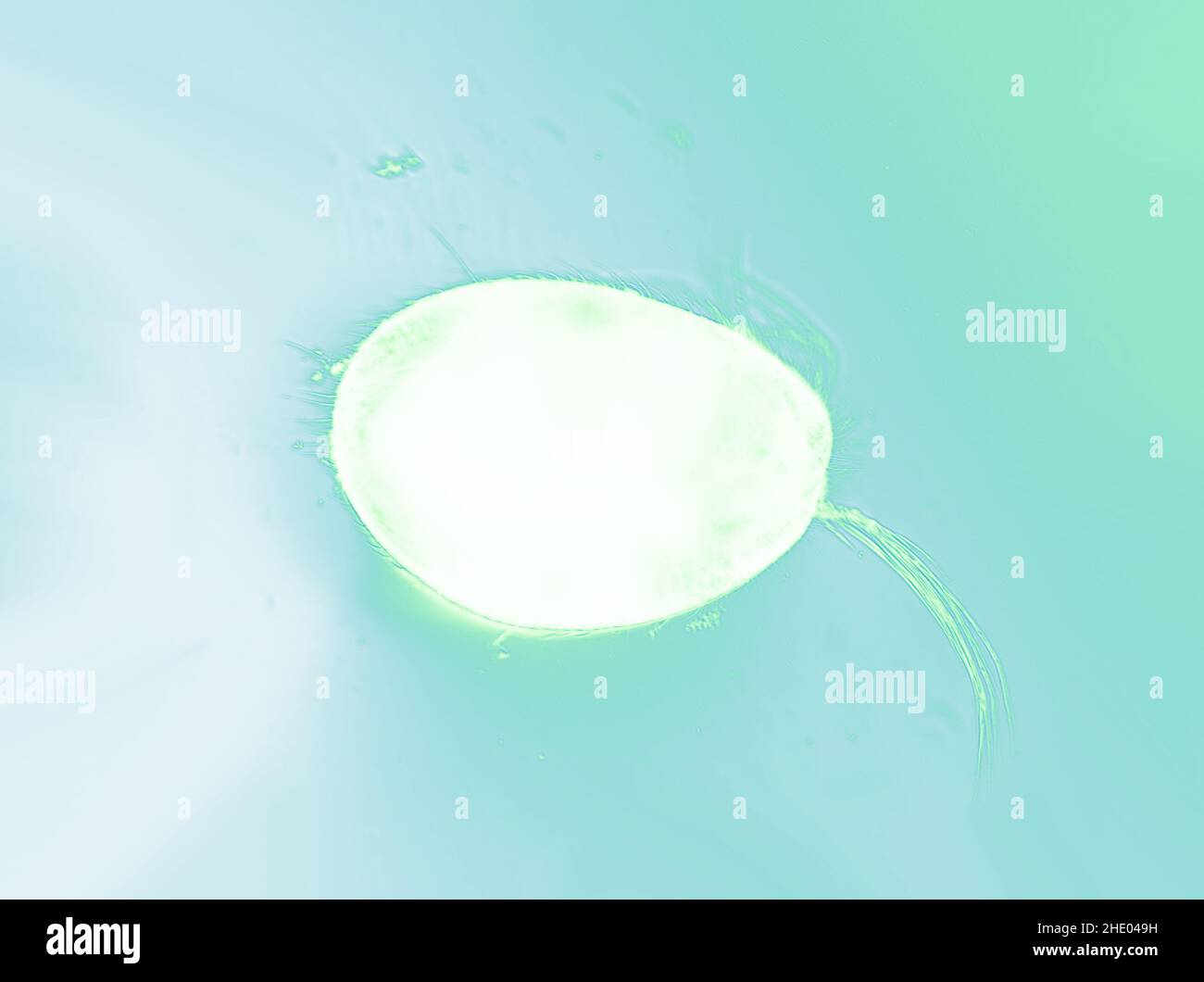 Microscopic freshwater Ostracod aka seed shrimp, taken from a pond of ...