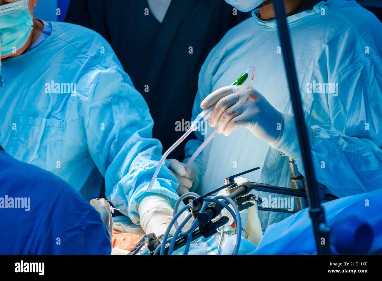 Surgeons hands, catheter hi-res stock photography and images - Alamy