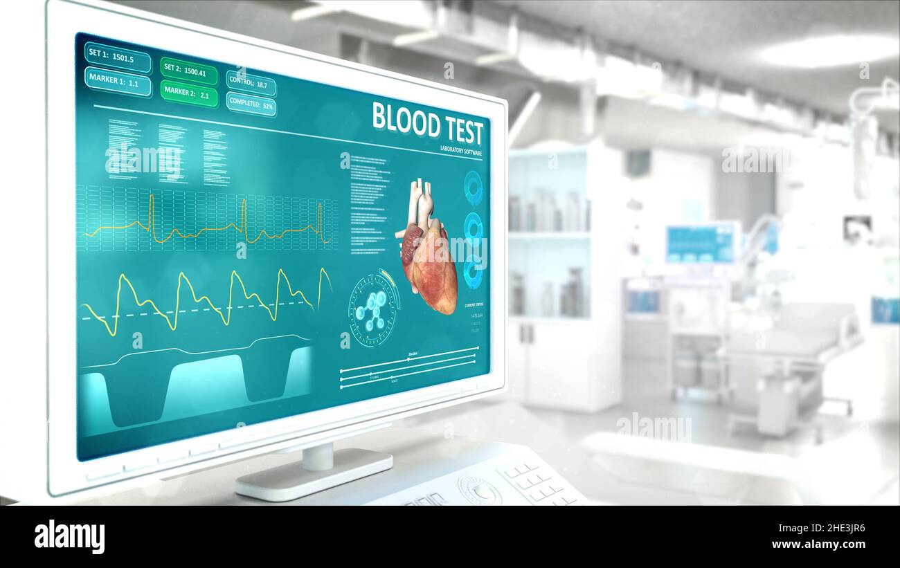blood sample test on monitor in hi-tech hospital room . cgi industrial ...
