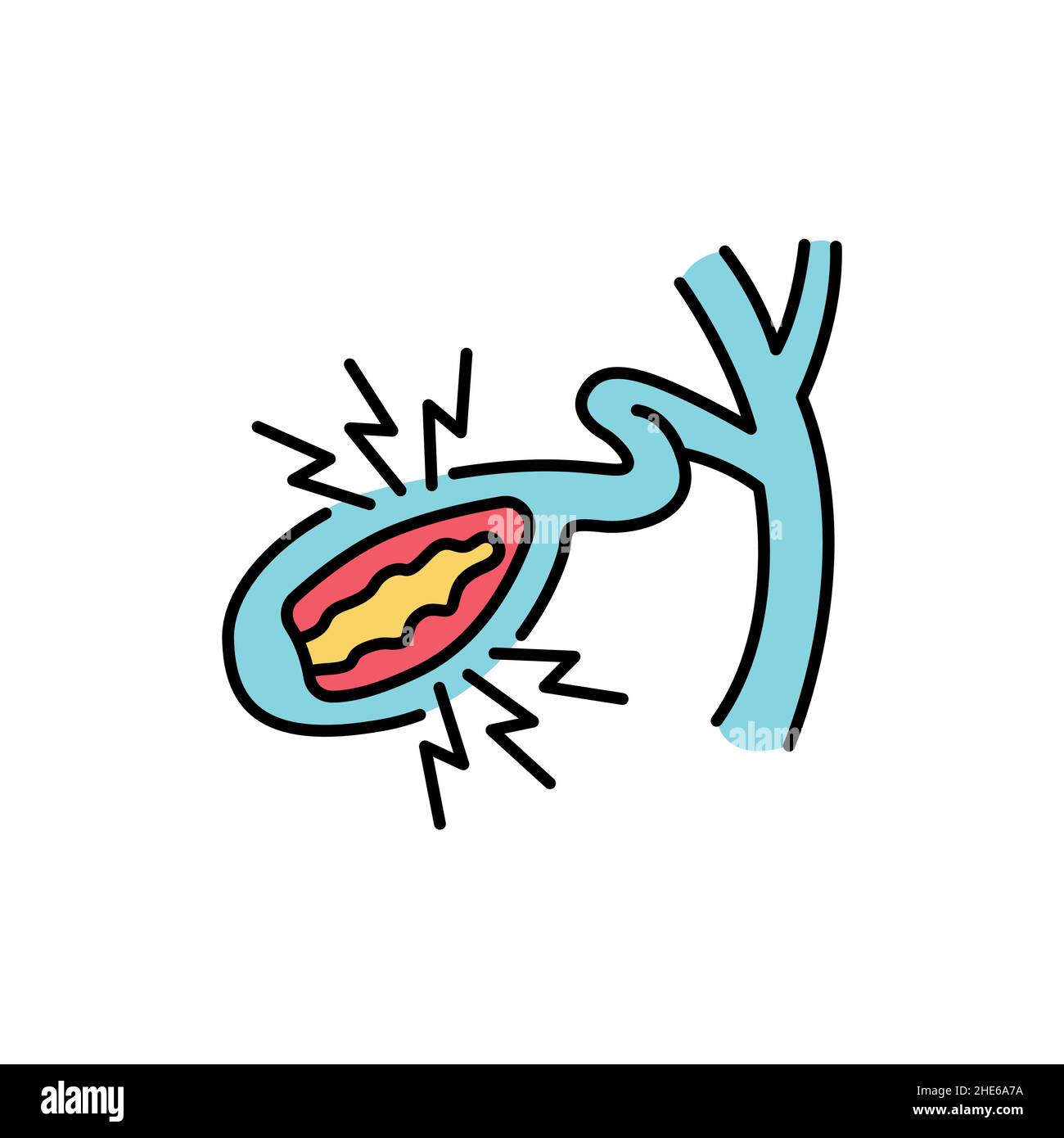 Cholesterosis gallbladder color line icon. Human diseases Stock Vector ...