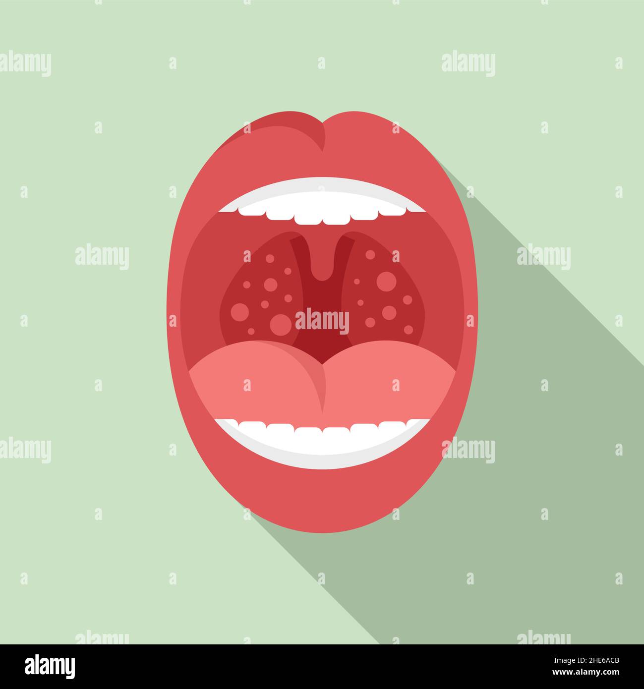 Mouth tonsillitis icon flat vector. Tonsil anatomy. Bacterial ent Stock ...