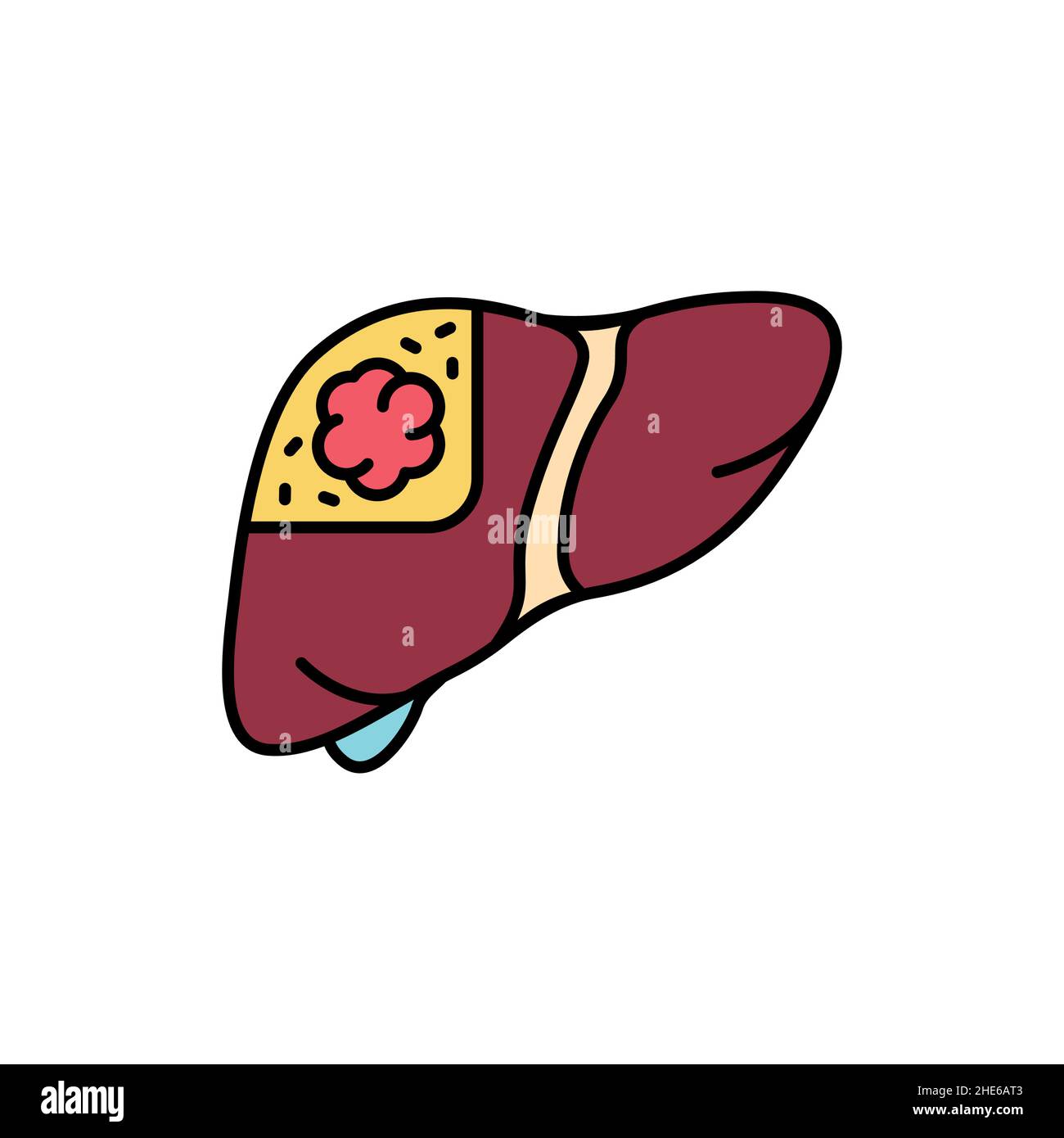 Cancer liver color line icon. Human diseases Stock Vector Image & Art ...