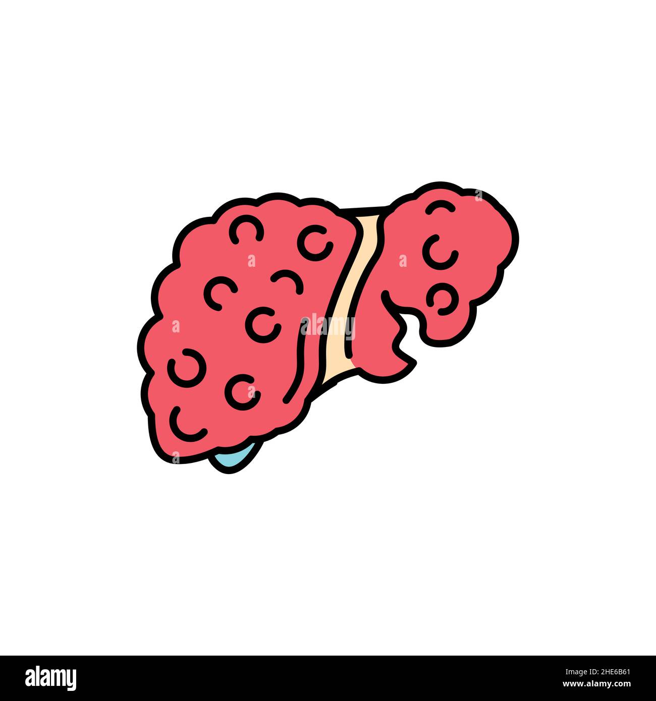Liver disease progression hi-res stock photography and images - Alamy