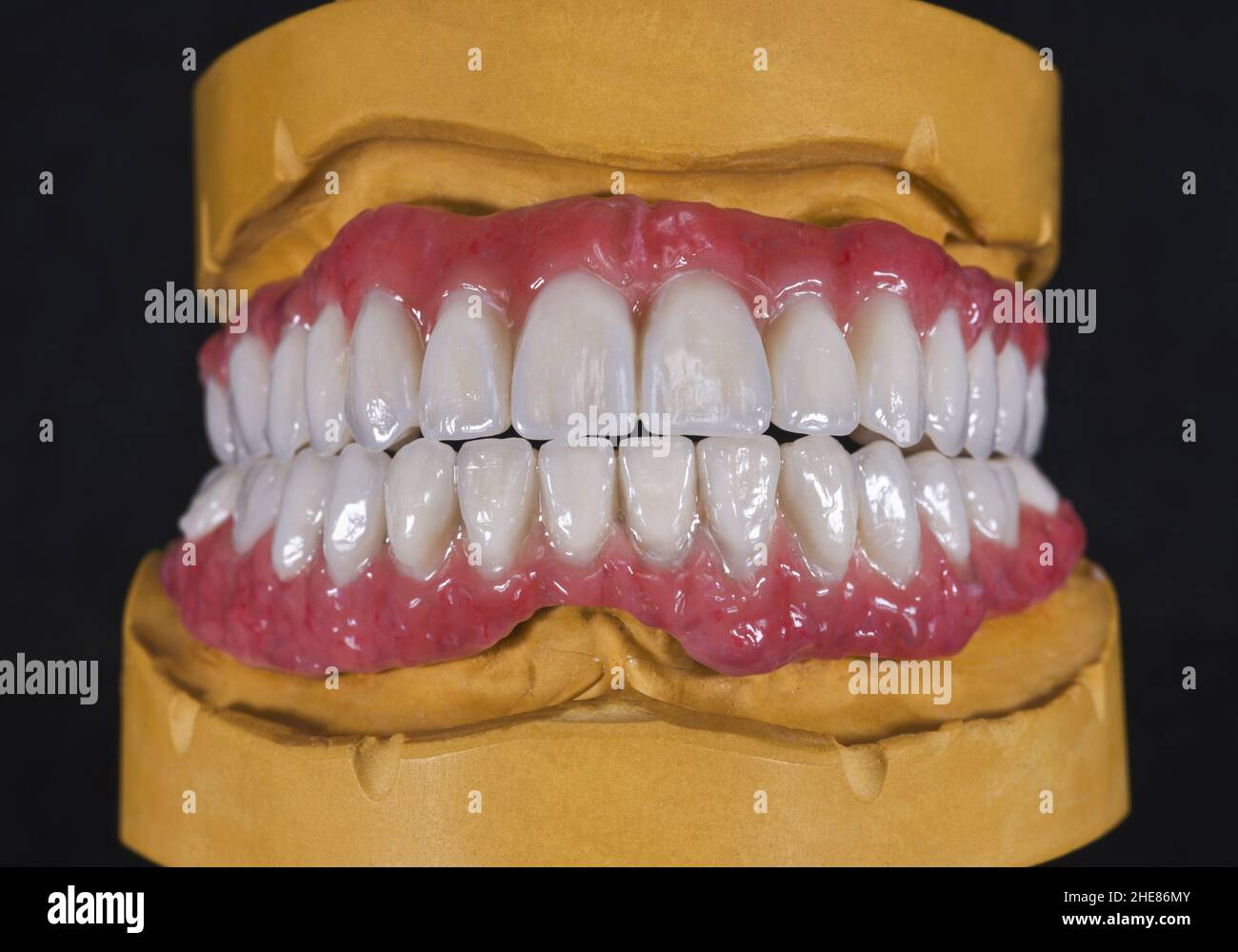 Full set of ceramic teeth model on a black background Stock Photo - Alamy