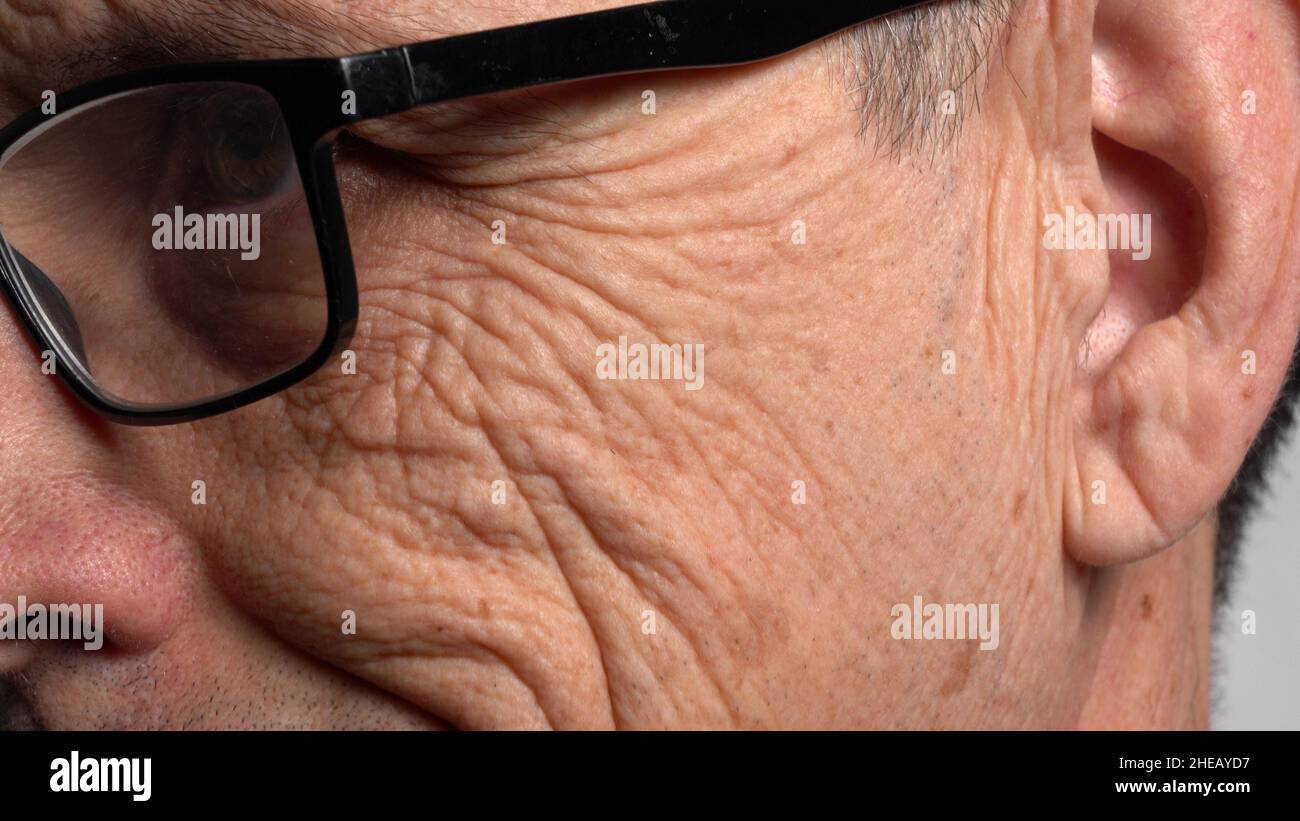 Male Facial wrinkles texture background. Portrait man's face Wrinkles ...