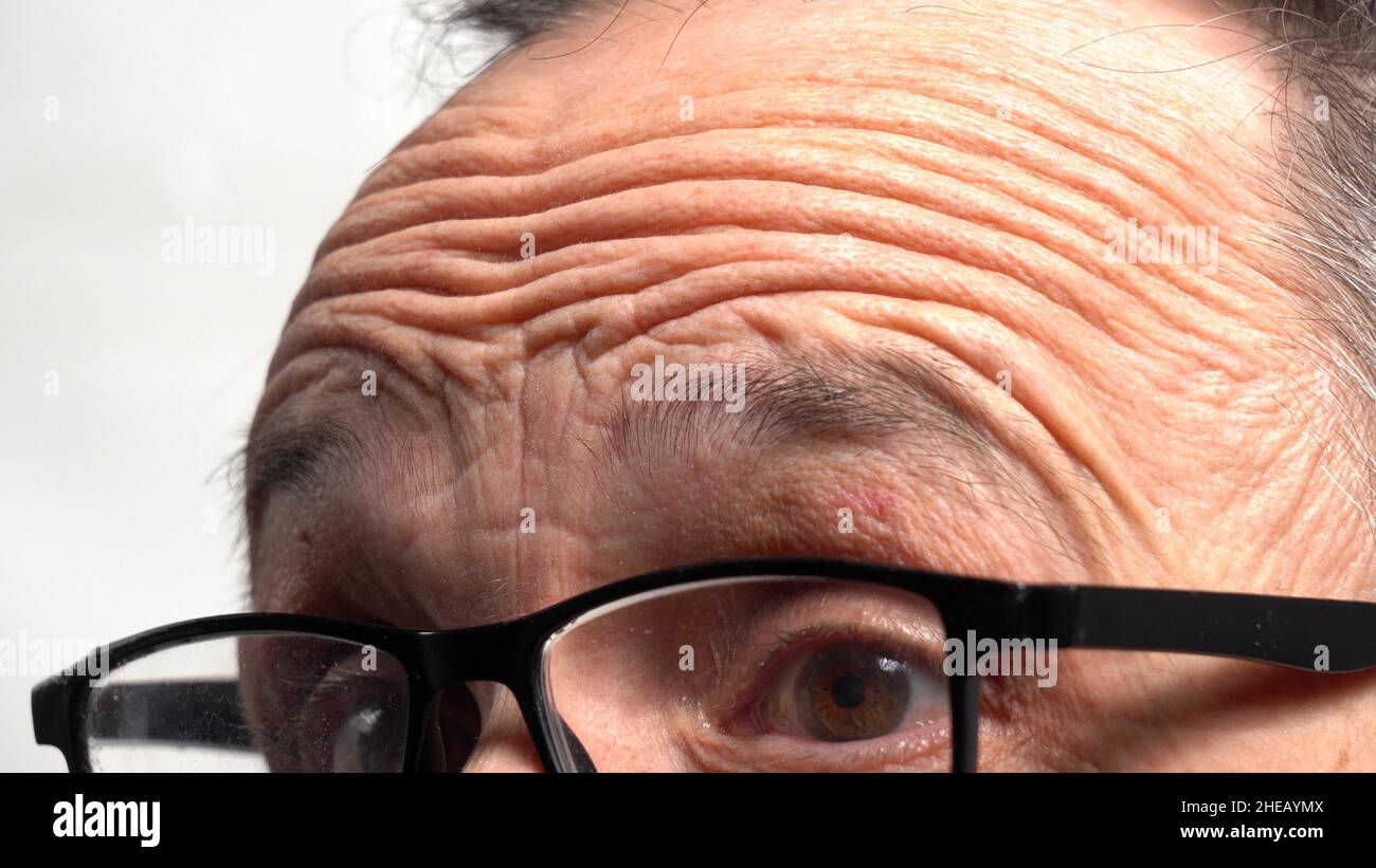 Skin folds on the forehead of an older man Stock Photo - Alamy