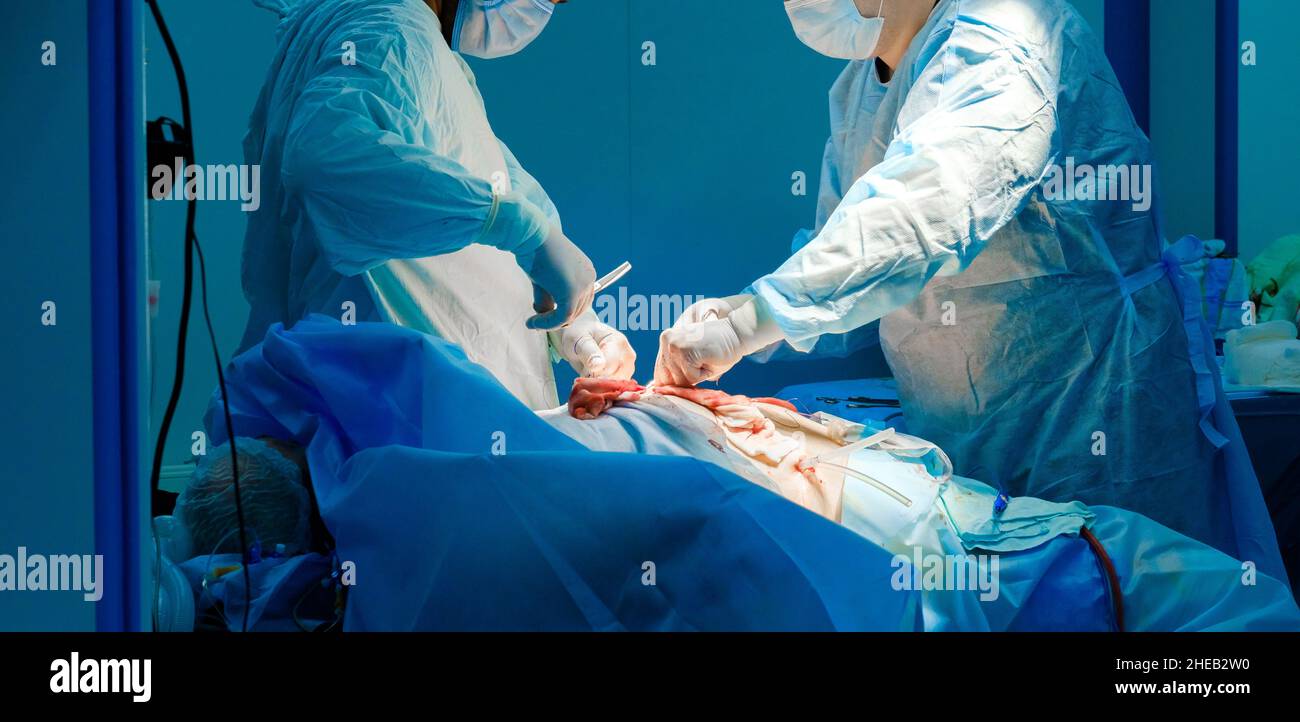 Two surgeons in blue uniforms operate on a patient on an operating ...