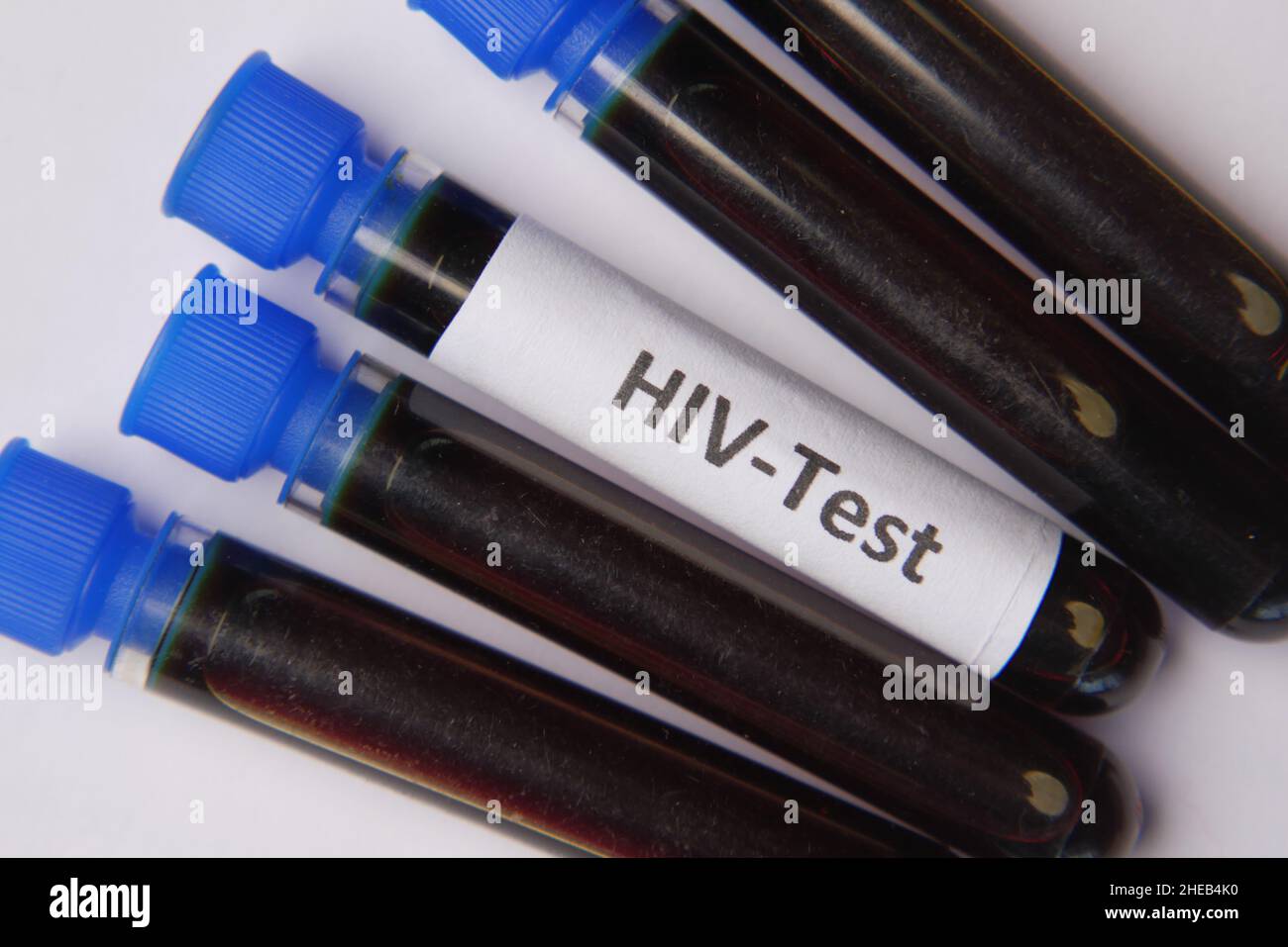 Positive hiv blood test hi-res stock photography and images - Alamy