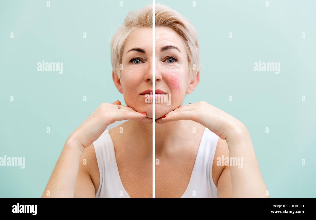 Professional cosmetology. Portrait of a adult caucasian woman with ...