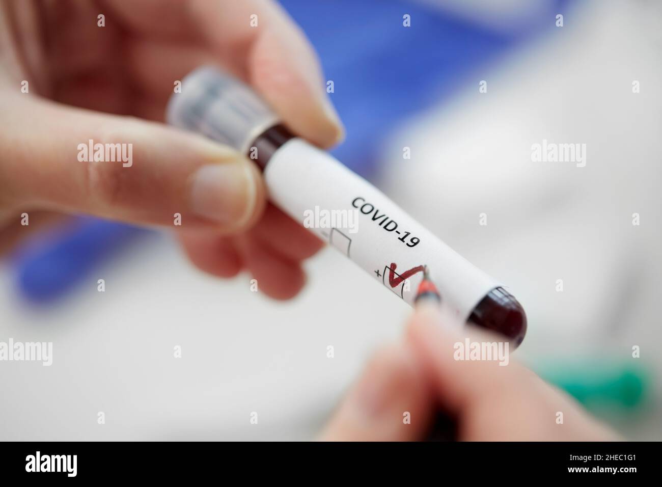 hand holding beaker with coronavirus blood test Stock Photo - Alamy