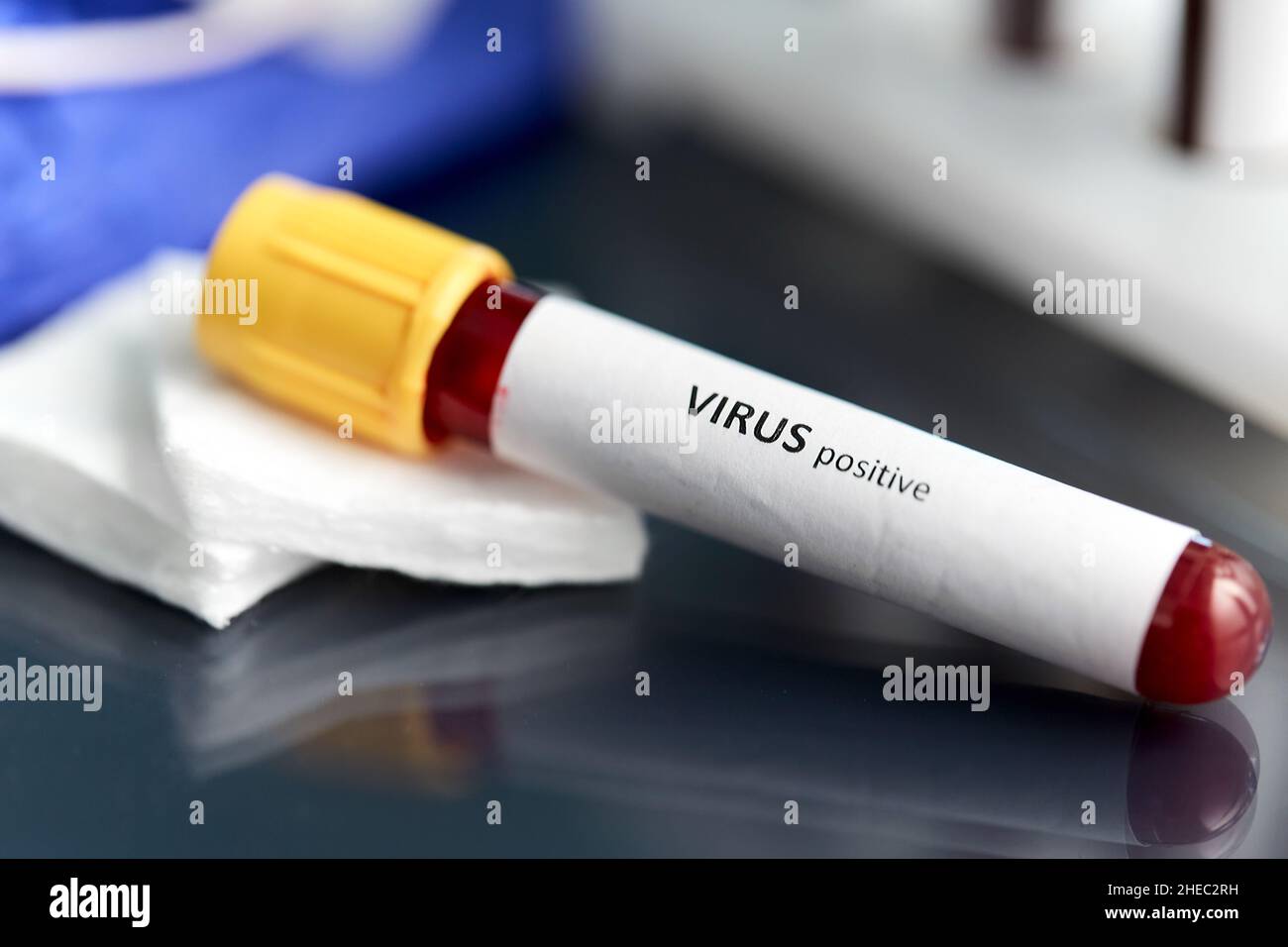 beaker with virus blood test at laboratory Stock Photo - Alamy