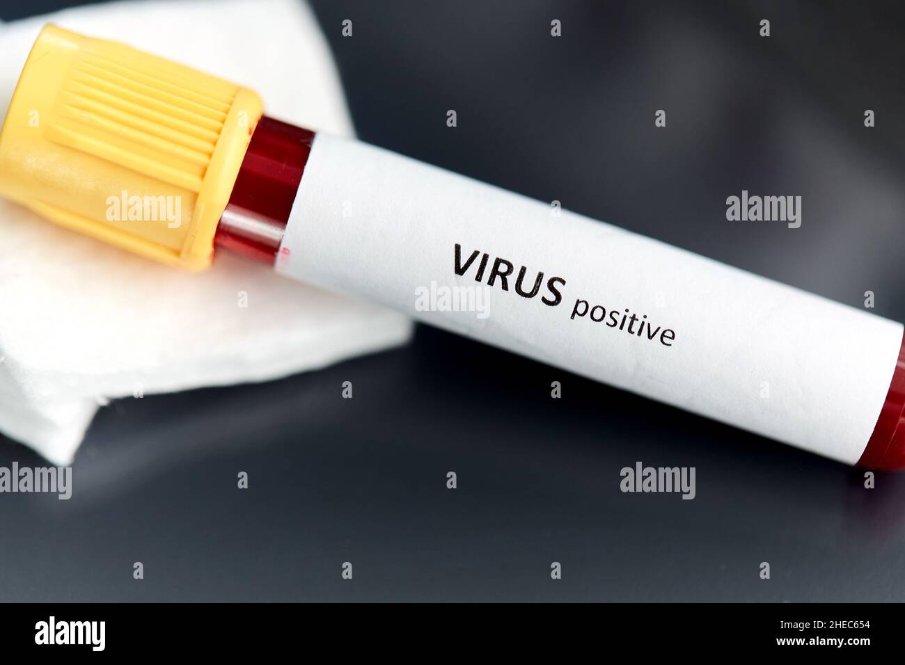 beaker with virus blood test at laboratory Stock Photo - Alamy