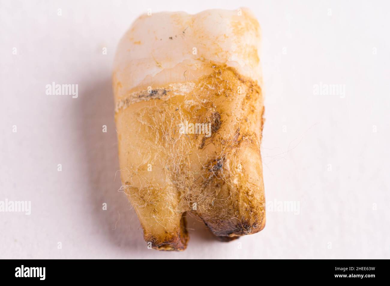 extracted dirty white tooth with root Stock Photo - Alamy