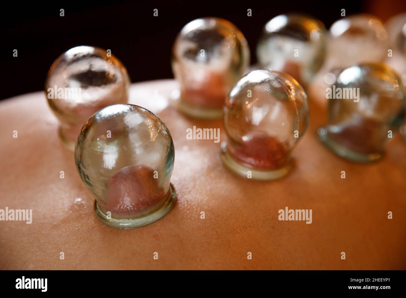Traditional cure hi-res stock photography and images - Alamy