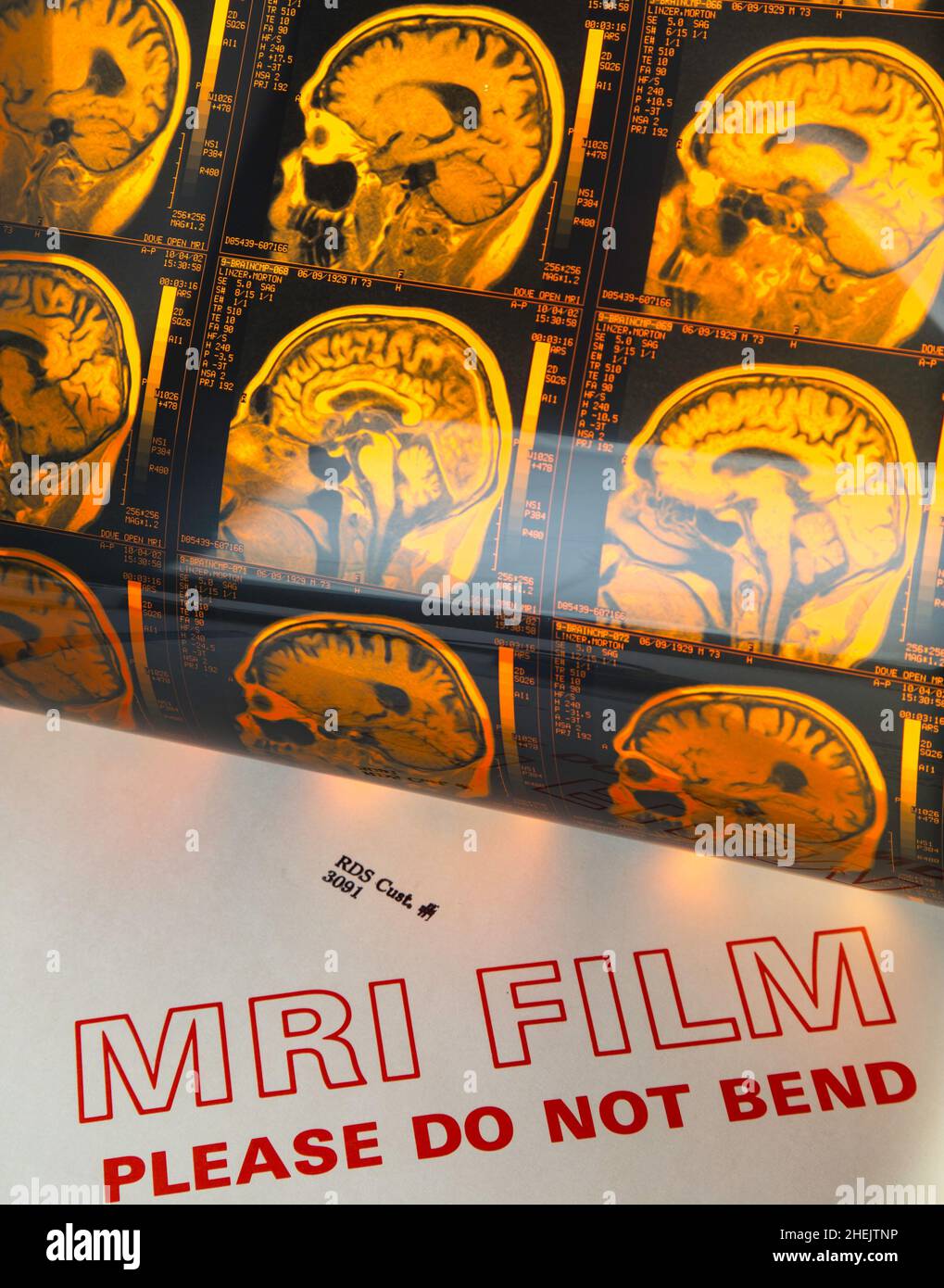Magnetic Resonance Imaging (MRI) Film and Folder, USA 2013 Stock Photo ...