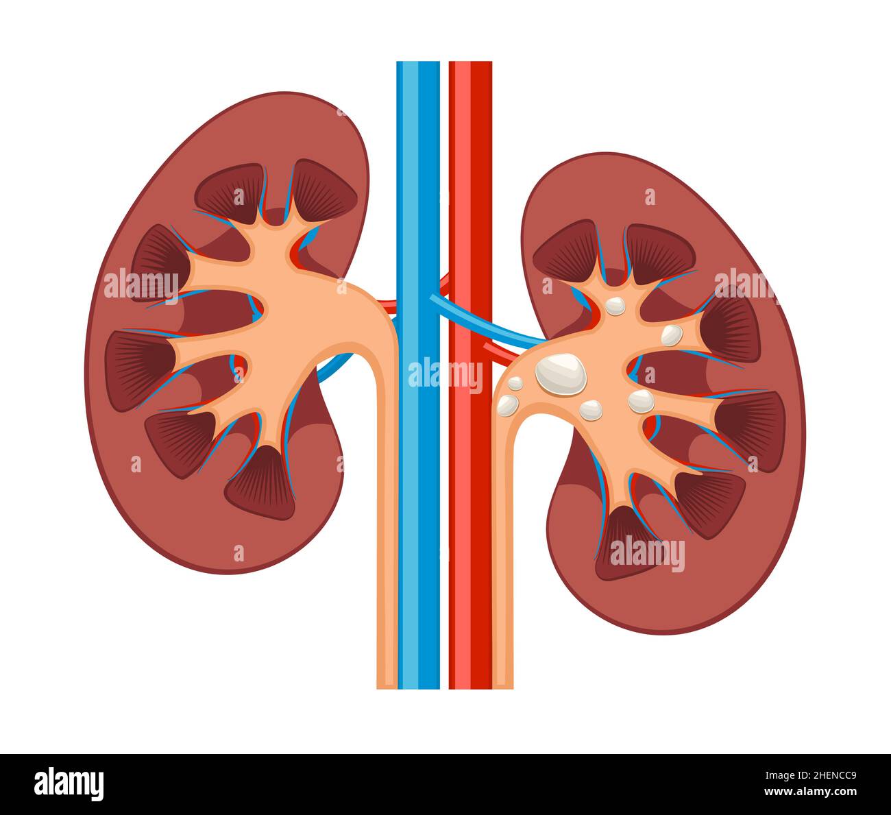 Kidney renal flat realistic icon. Human kidney anatomy vector organ ...