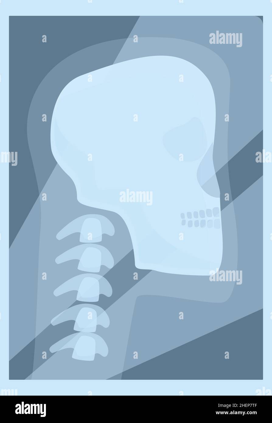 Xray shoulder scan icon cartoon vector. Medical machine. Health test ...