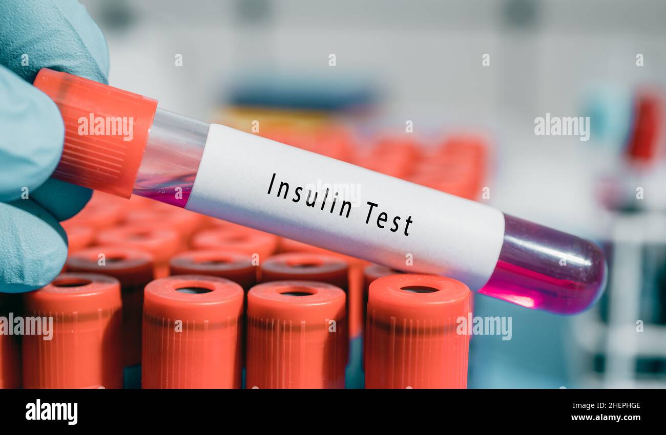 Pancreas Insulin Test Lowers blood sugar levels; stimulates metabolism ...