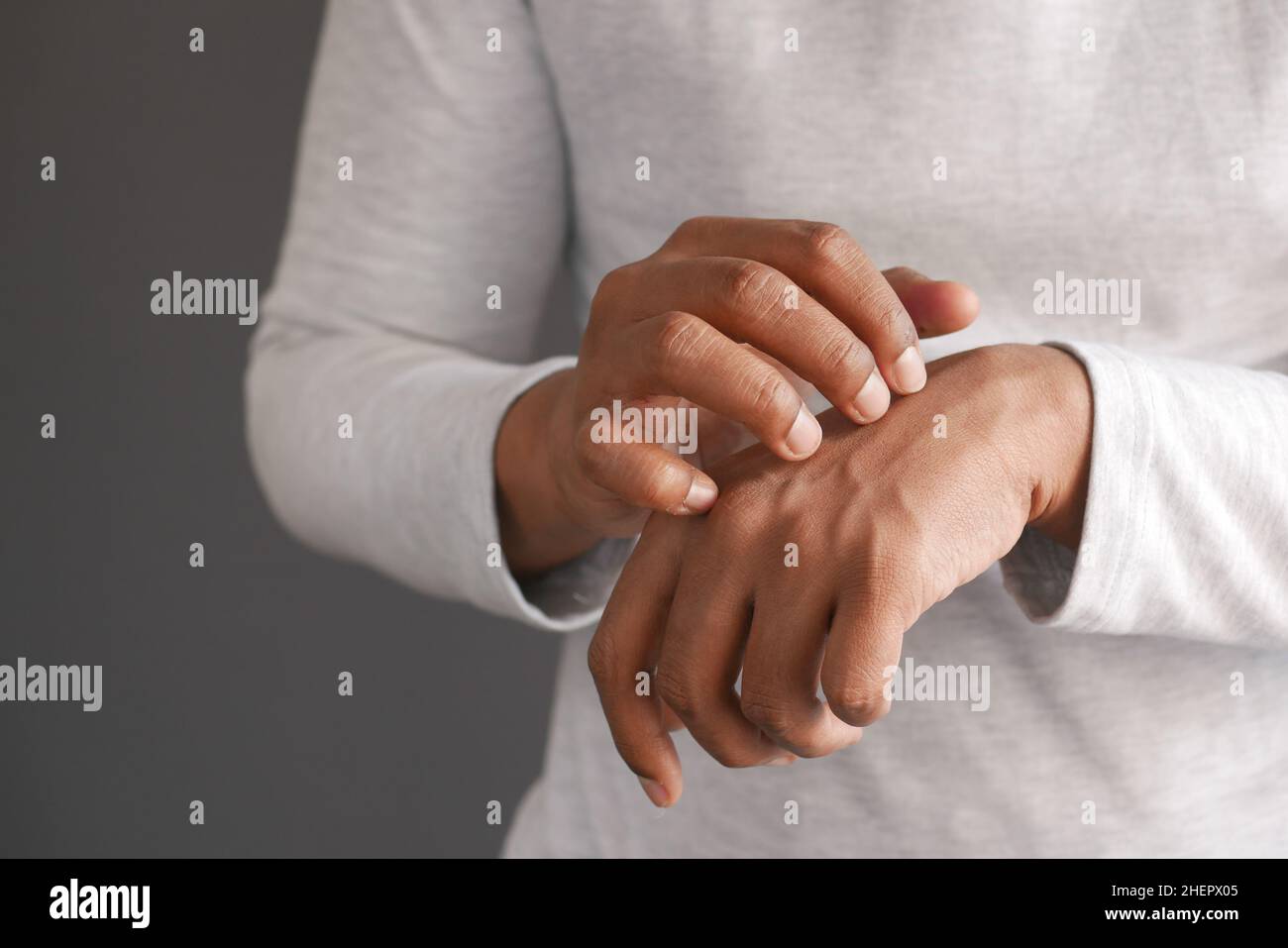 man suffering from itching skin, close up Stock Photo - Alamy