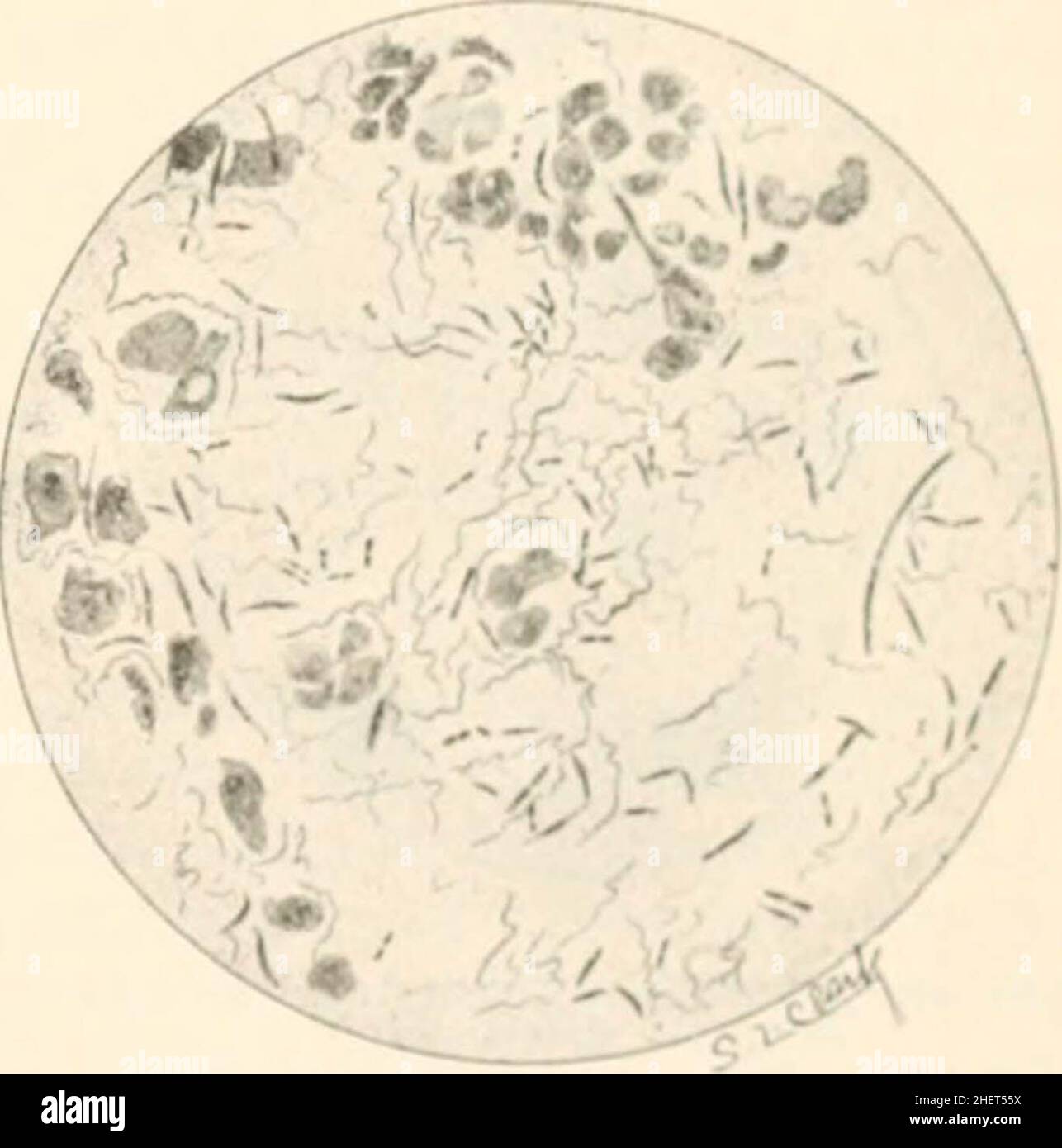 Pathologic hi-res stock photography and images - Alamy