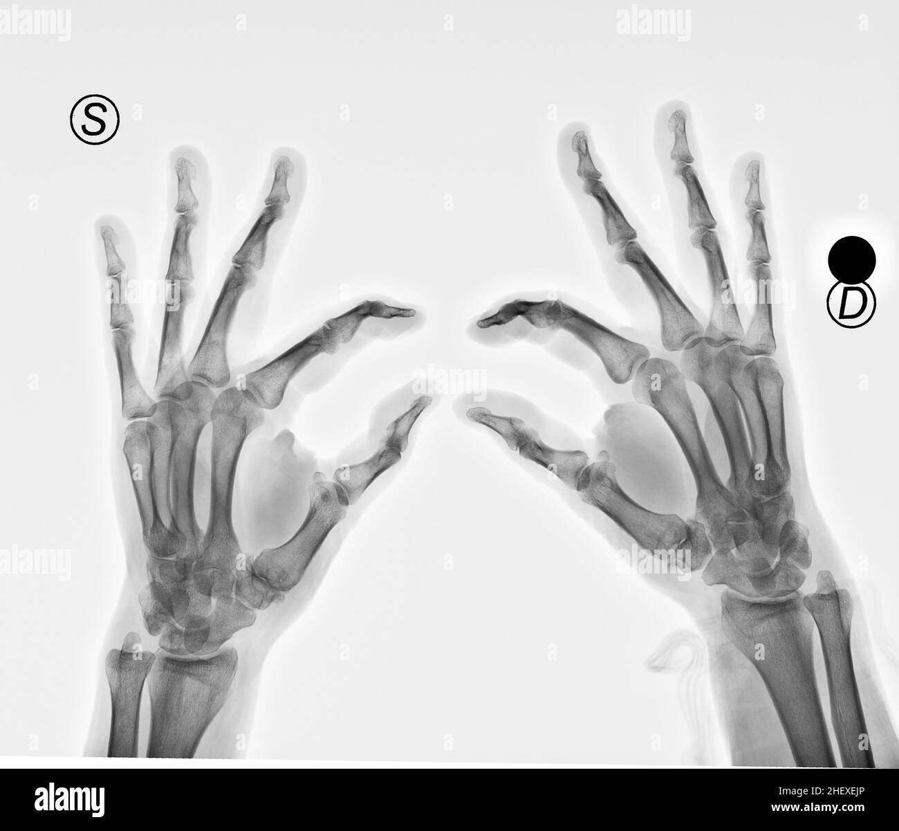 X ray x ray hi-res stock photography and images - Alamy