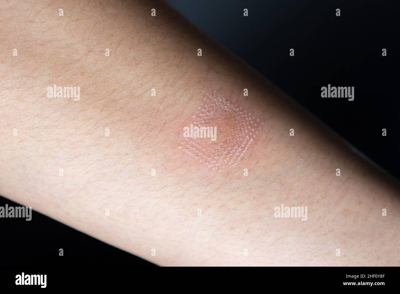 Scar hand hi-res stock photography and images - Alamy