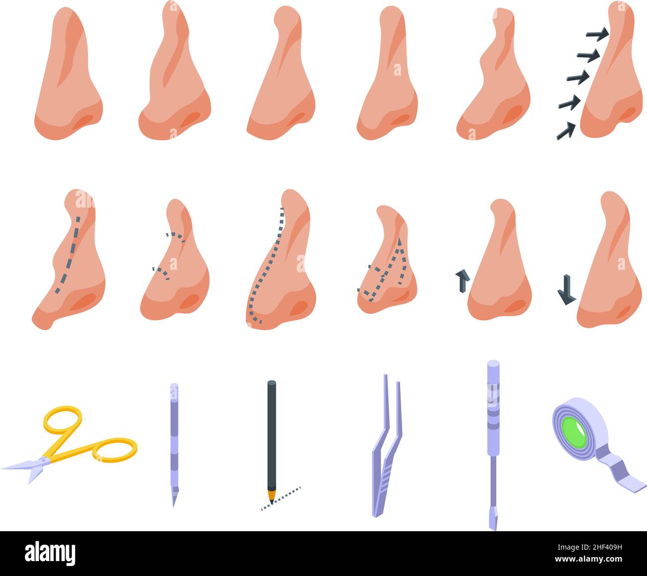 Rhinoplasty icons set isometric vector. Human nose. Closed open Stock ...